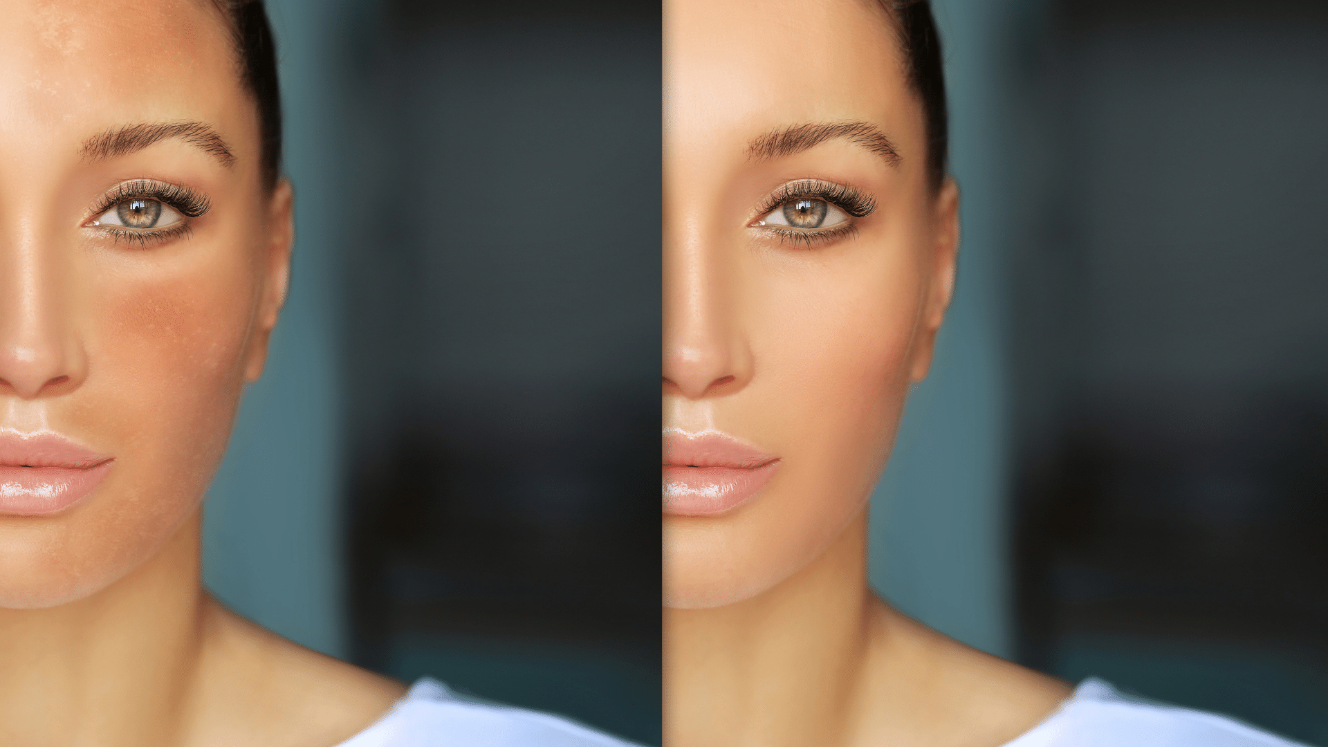 Hyperpigmentation - Kirtis' Homoeo Cure Clinic
